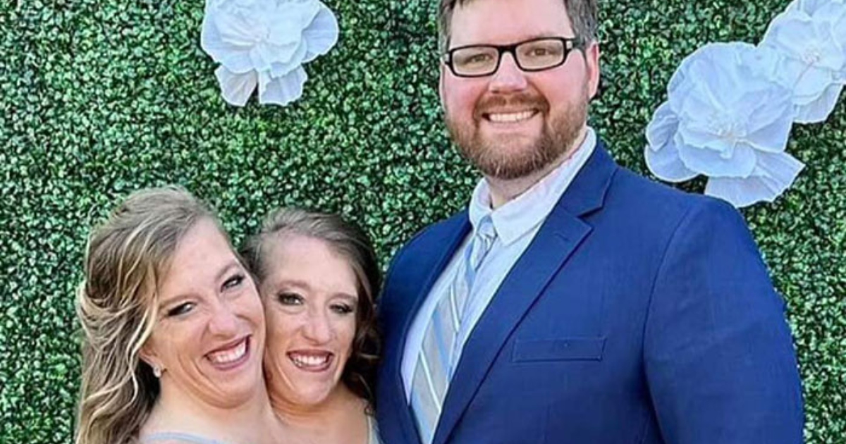 Hensel Twins Welcome a Child Amid Skepticism: Is Pregnancy Even ...